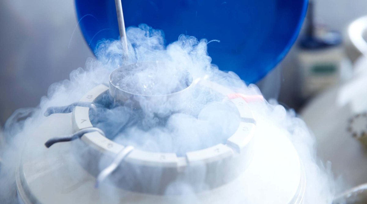 Can Cord Blood and Cord Tissue be Used Later in Life? | AlphaCord